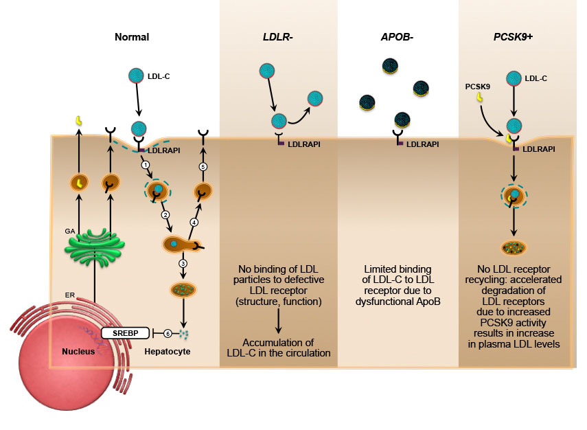 familial-hypercholesterolemia-mayo-clinic-research