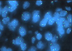 Fluorescence in Situ Hybridization (FISH) - Cytogenetics Core - Mayo Clinic Research