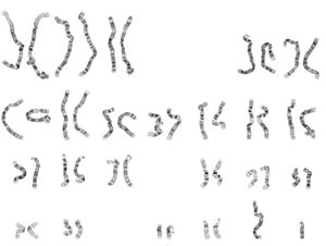 Routine cytogenetic analysis - Cytogenetics Core - Mayo Clinic Research