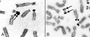 Routine cytogenetic analysis - Cytogenetics Core - Mayo Clinic Research