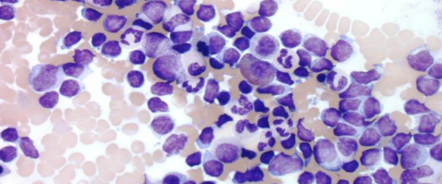 b lymphocytes low