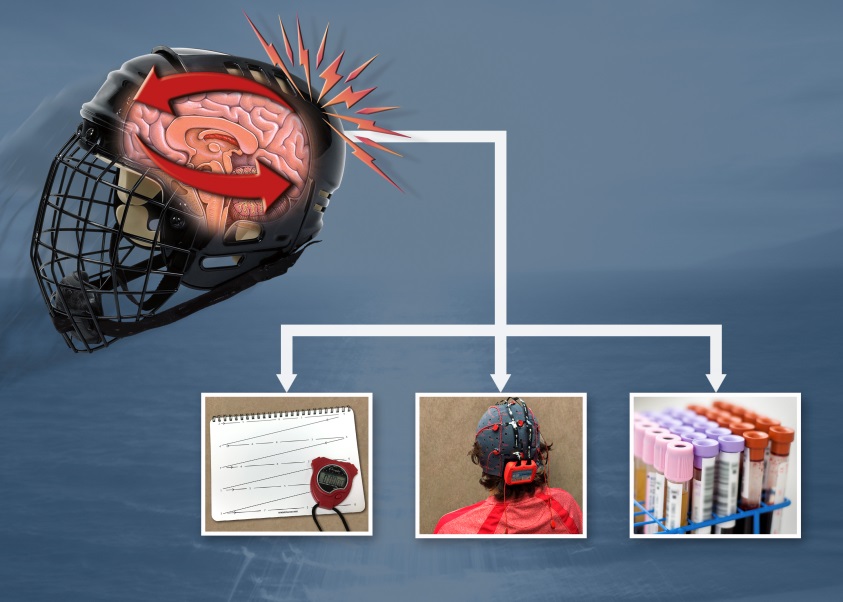 Hockey - Sports Medicine Research - Mayo Clinic Research