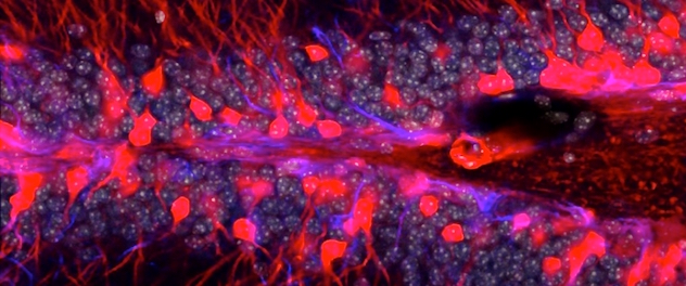 Overview - Neurosurgery Research - Mayo Clinic Research