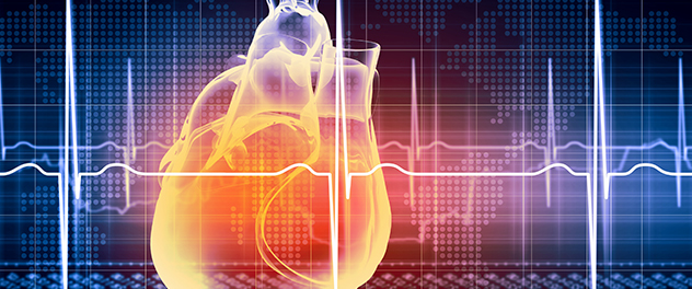 Overview - Cardiovascular Disease and Outcomes Research Program - Mayo ...