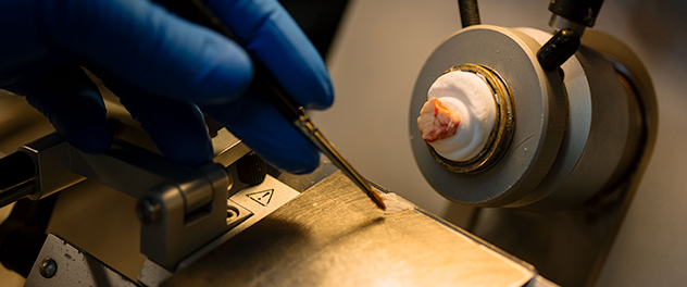 Tissue Handling - Pathology Research Core - Mayo Clinic Research