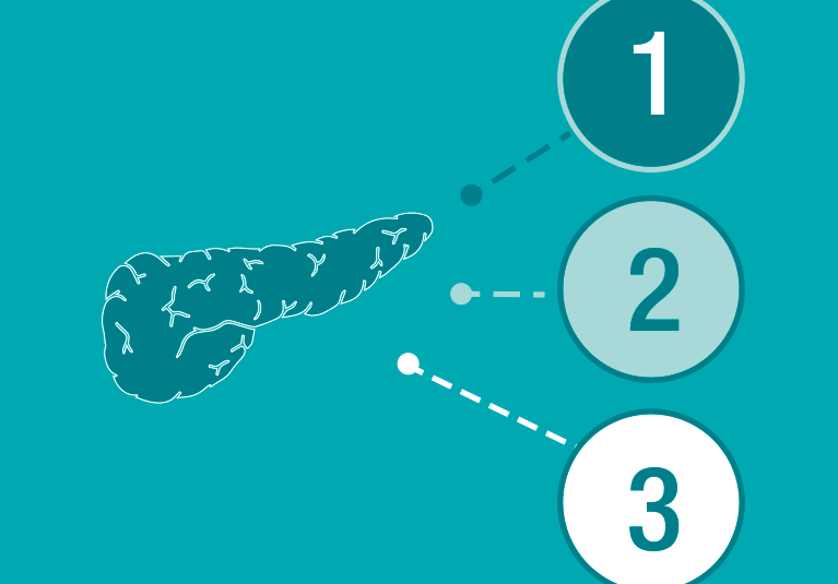 Overview Mayo Clinic Pancreatic Cancer Spore Mayo Pancreatic ultrasound ...