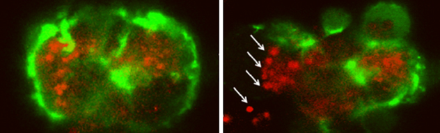 Vesicular trafficking, cytoskeletal dynamics and signaling in acinar ...
