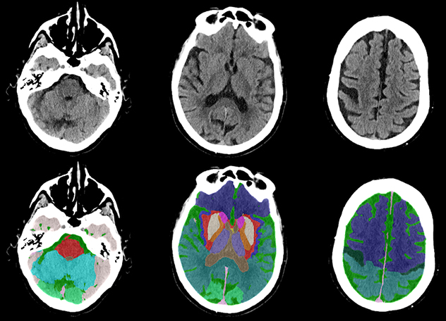 Clinically Focused Projects - Radiology Informatics: Bradley J. Erickson - Mayo Clinic Research