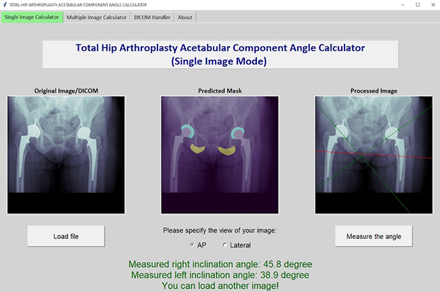 Clinically Focused Projects - Radiology Informatics: Bradley J. Erickson - Mayo Clinic Research