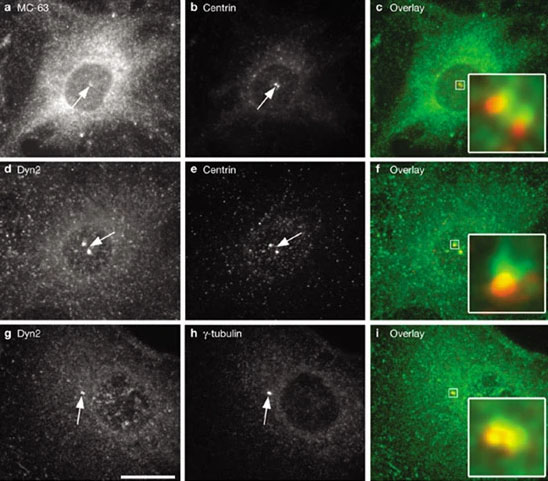 Images - Membrane Trafficking in Disease - Mayo Clinic Research