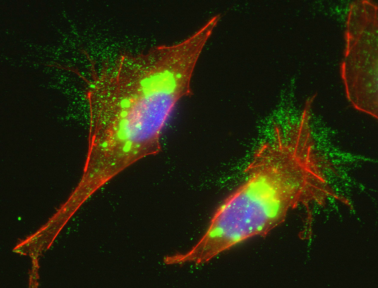 Images - Membrane Trafficking in Disease - Mayo Clinic Research
