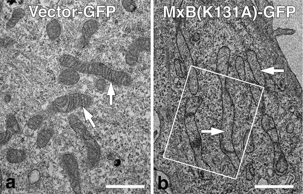 Images - Membrane Trafficking in Disease - Mayo Clinic Research