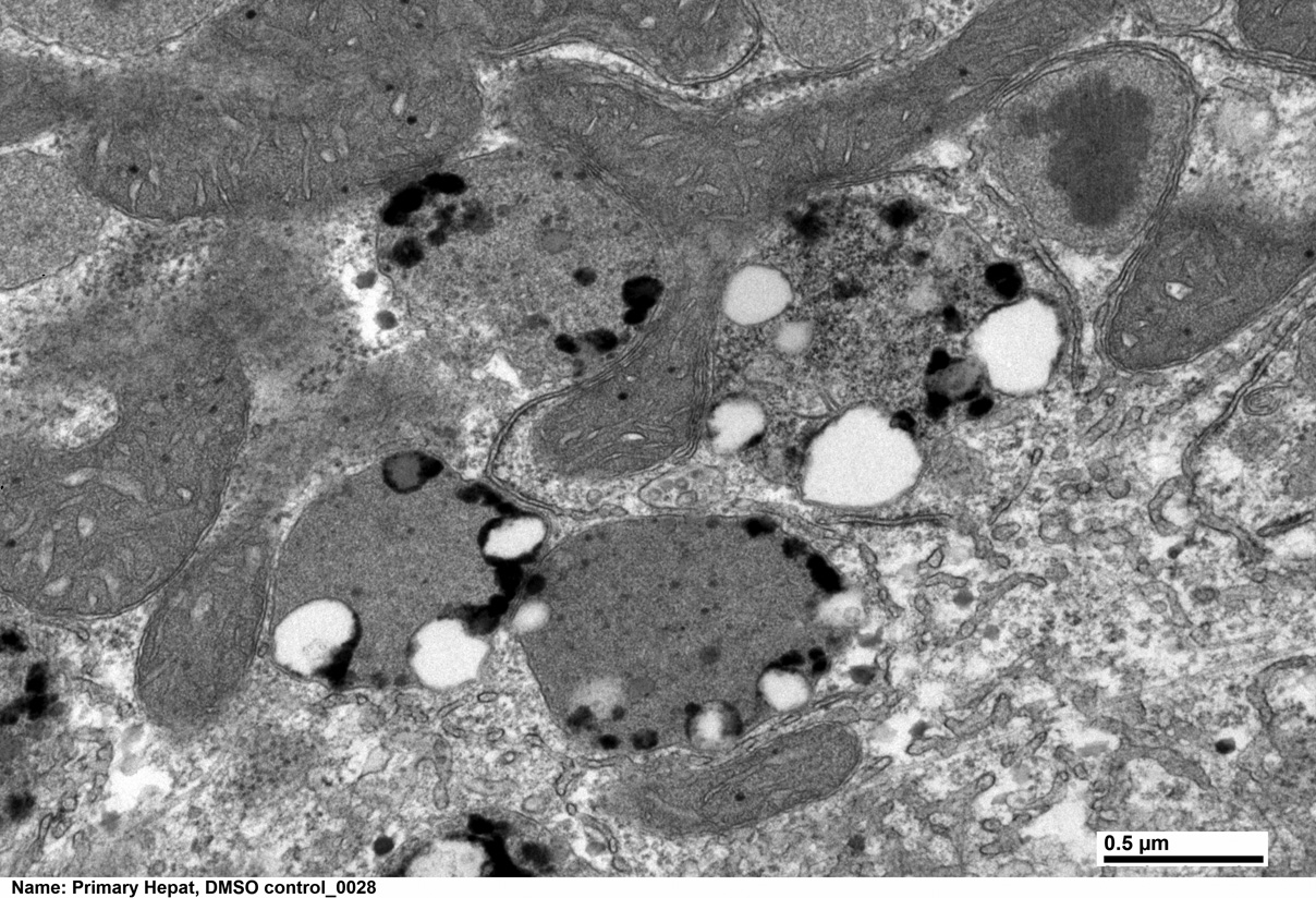 Images - Membrane Trafficking in Disease - Mayo Clinic Research