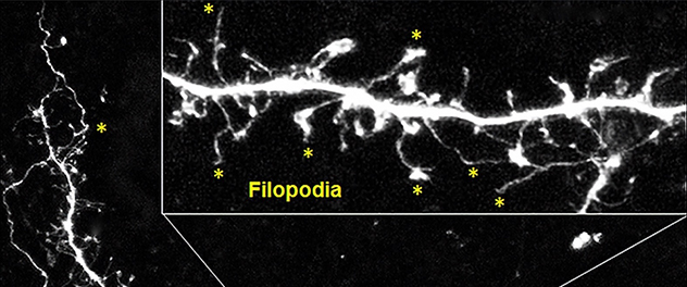 Altered microglial function with augmented neuritogenic factor by ...